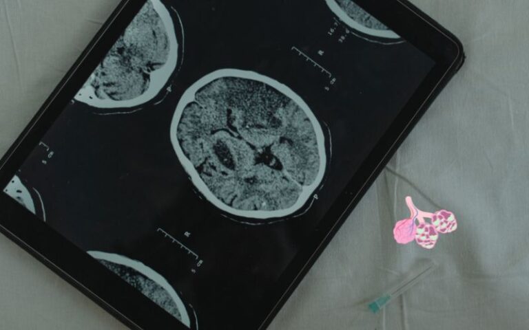 Is Brain Edema Curable? Neurosurgeon in Delhi - Centre for Brain and Spine